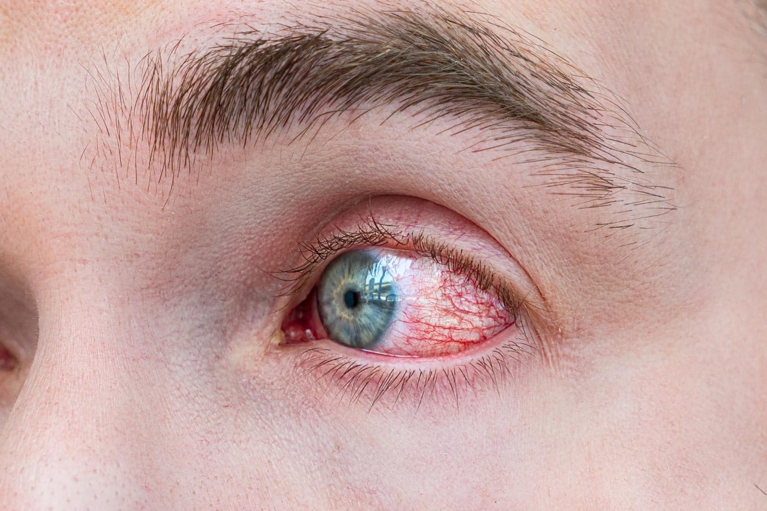 Exosome in Eye Therapy - Exosmart